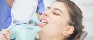 Everything You Need to Know About Scaling and Polishing Teeth