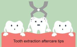 Tooth Extraction Aftercare: Precautions & Healing Procedure