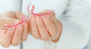 Types of Retainers: Which One is Best for You