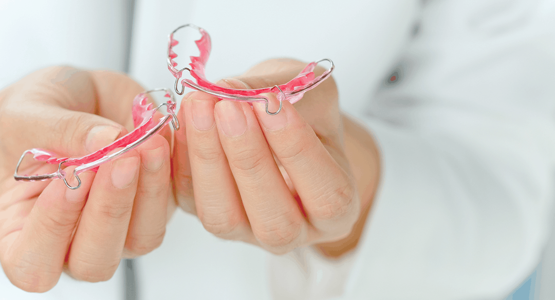 Types of Retainers: Which One is Best for You