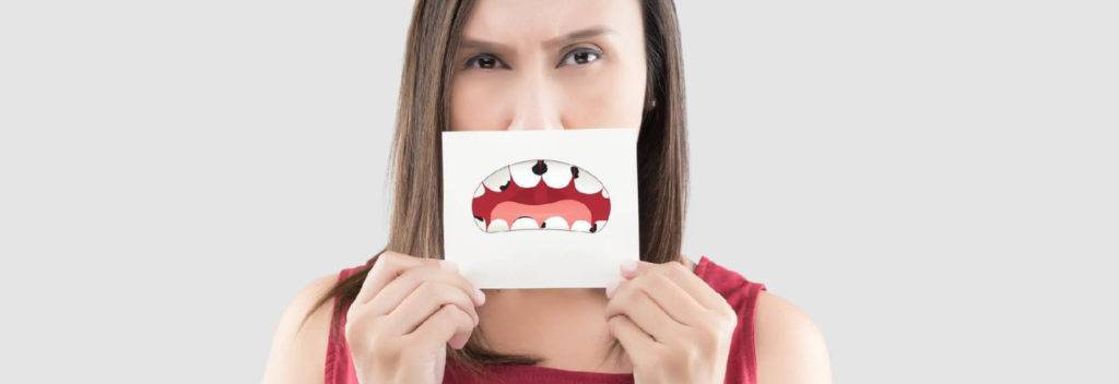 Exploring the Different Stages of Tooth Decay