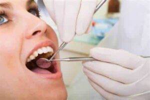 Here’s everything you need to know about FMR! – Sabka Dentist – Top ...
